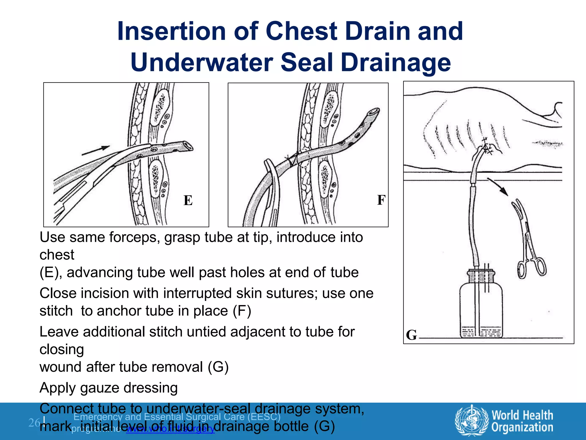 Emergency and trauma care | PPTX