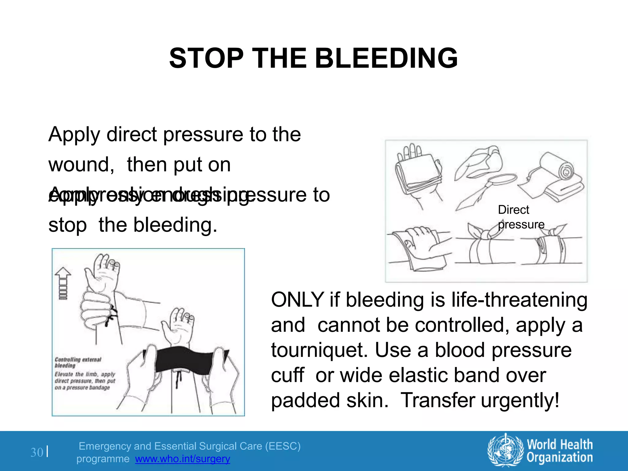 Emergency and trauma care | PPTX