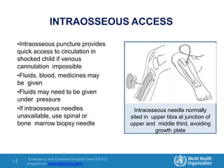 Emergency and trauma care | PPTX