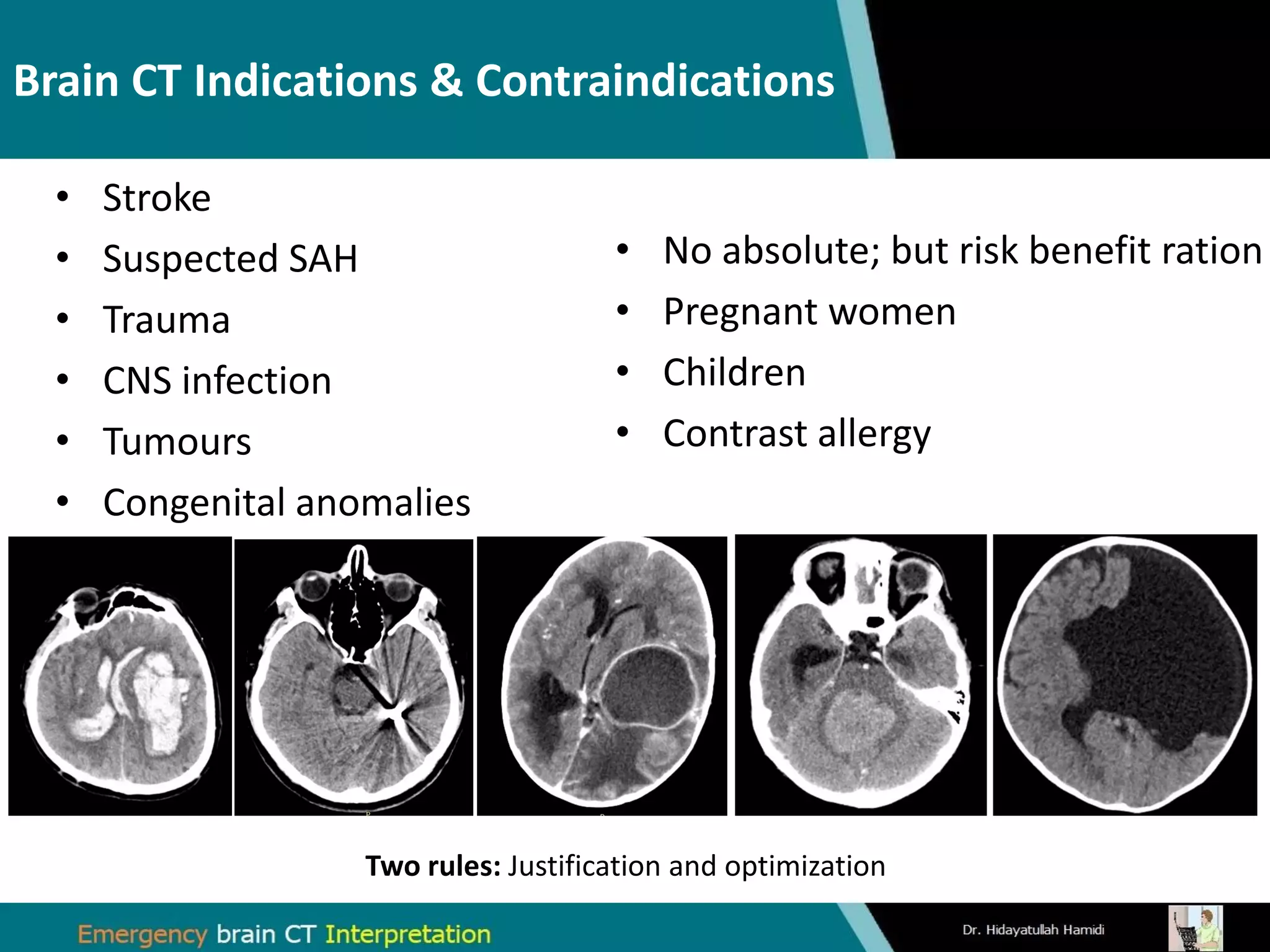 Emergency brain CT interpretation | PDF