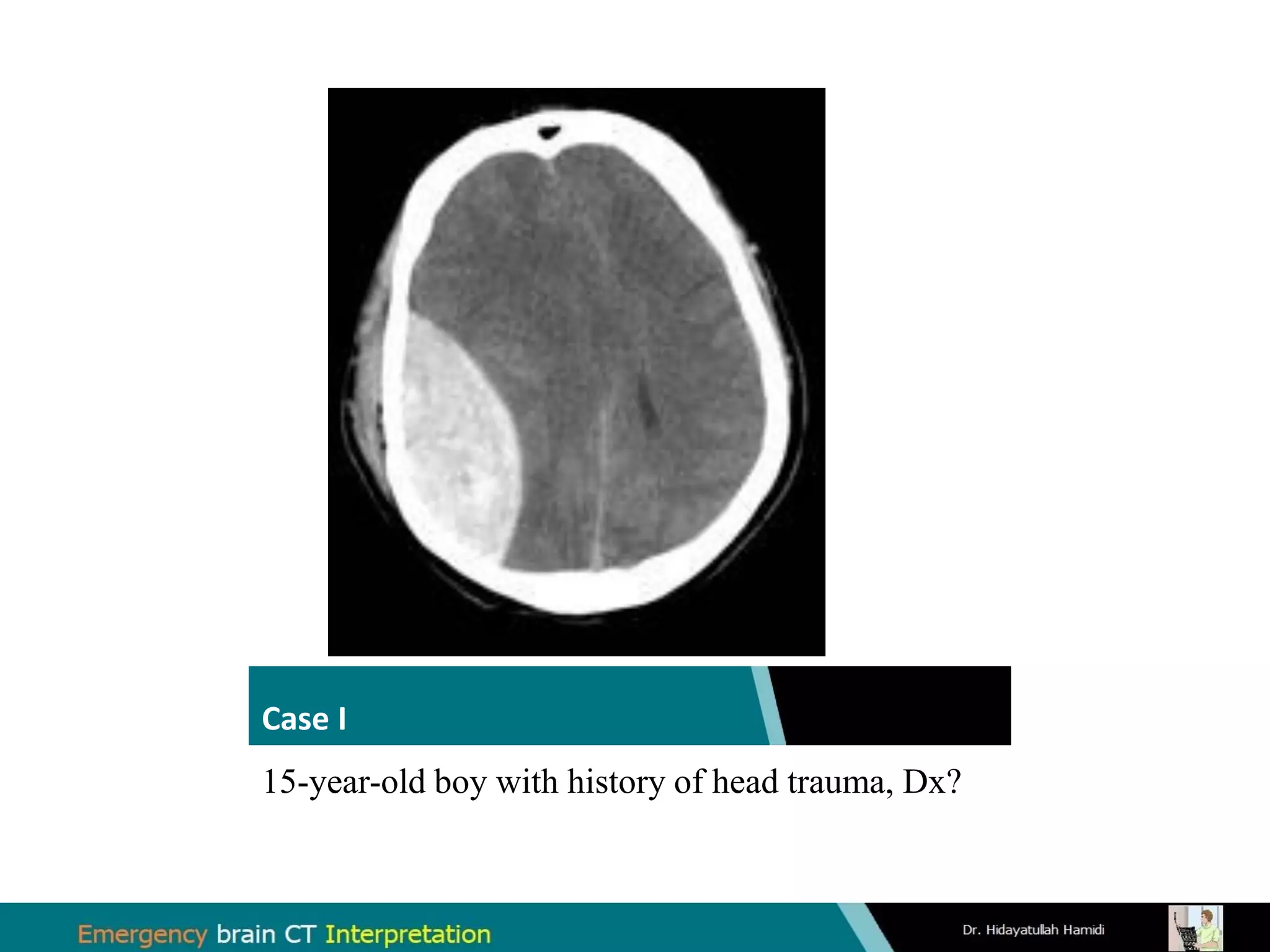 Emergency brain CT interpretation | PDF