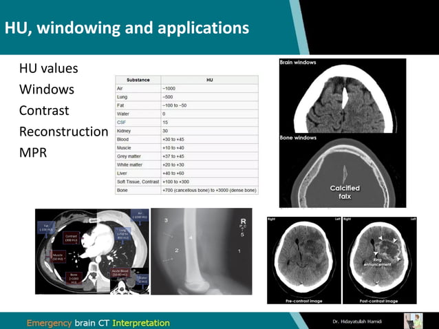 Emergency brain CT interpretation | PDF