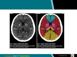 Emergency brain CT interpretation | PDF