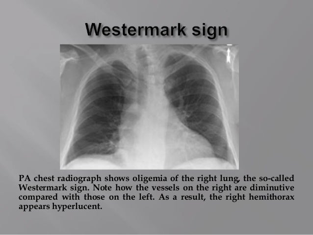 Emergency cadiopulmonary imaging