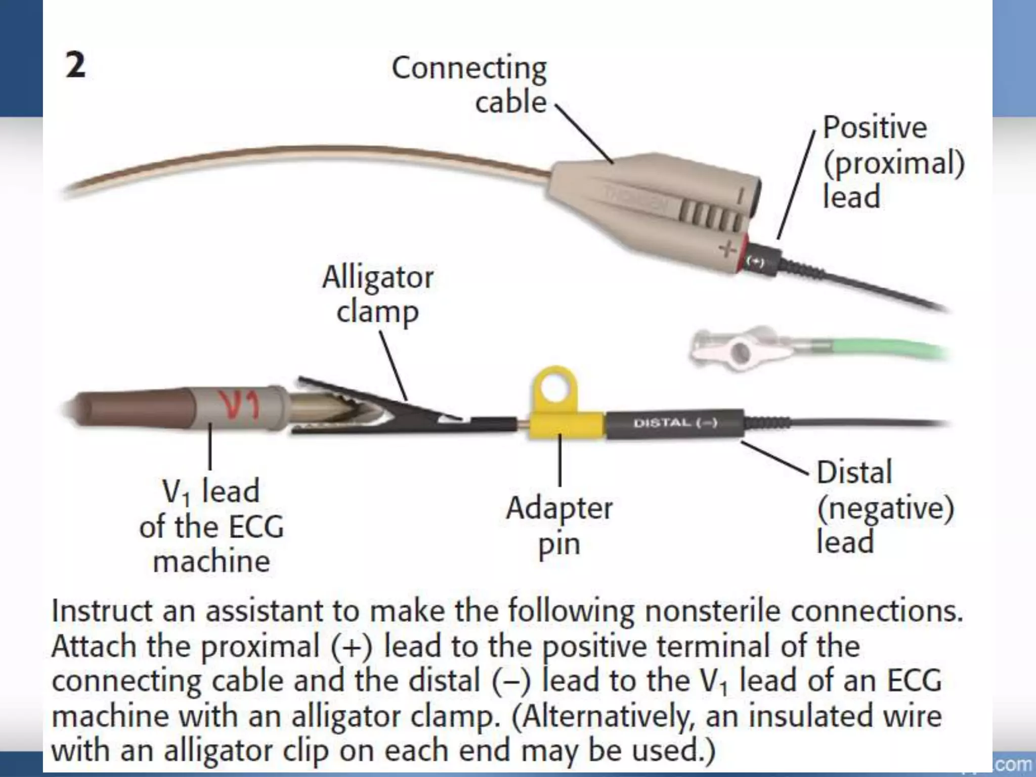 Emergency cardiac pacing | PPTX