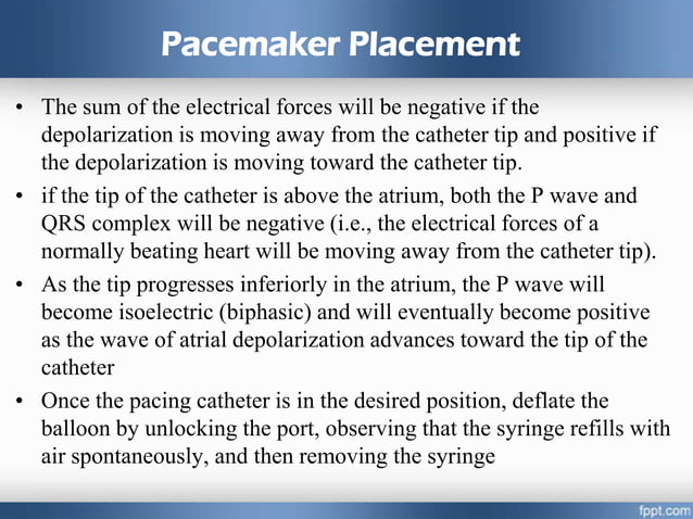 Emergency cardiac pacing | PPTX
