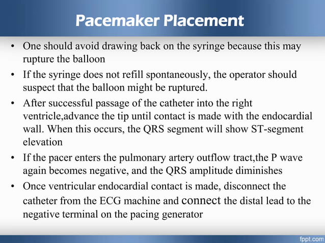 Emergency cardiac pacing | PPTX