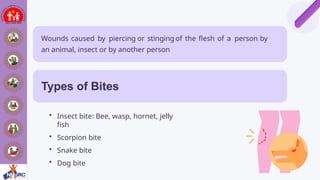 Emergency Care for anIMAL BITES.SN - Bites.pptx