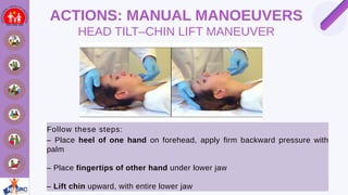 Emergency Care - Airway Management Principles | PDF