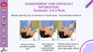 Emergency Care - Airway Management Principles | PDF