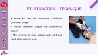 Emergency Care - Airway Management Principles | PDF