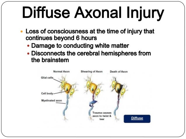 Emergency care to head injured patient