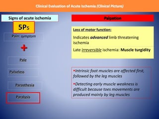 Acute Limb Ischemia - Emergency Case presentation | PPTX