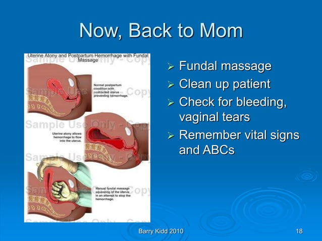 Emergency childbirth | PPT