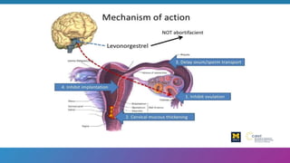Emergency_Contraception.ppt shneunzuksmsjjzn | PPT