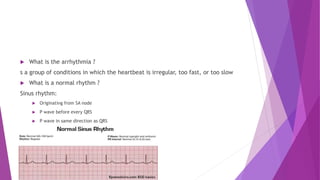 ARRHYTHMIA IN EMERGENCY DEPARTMENT | PPTX