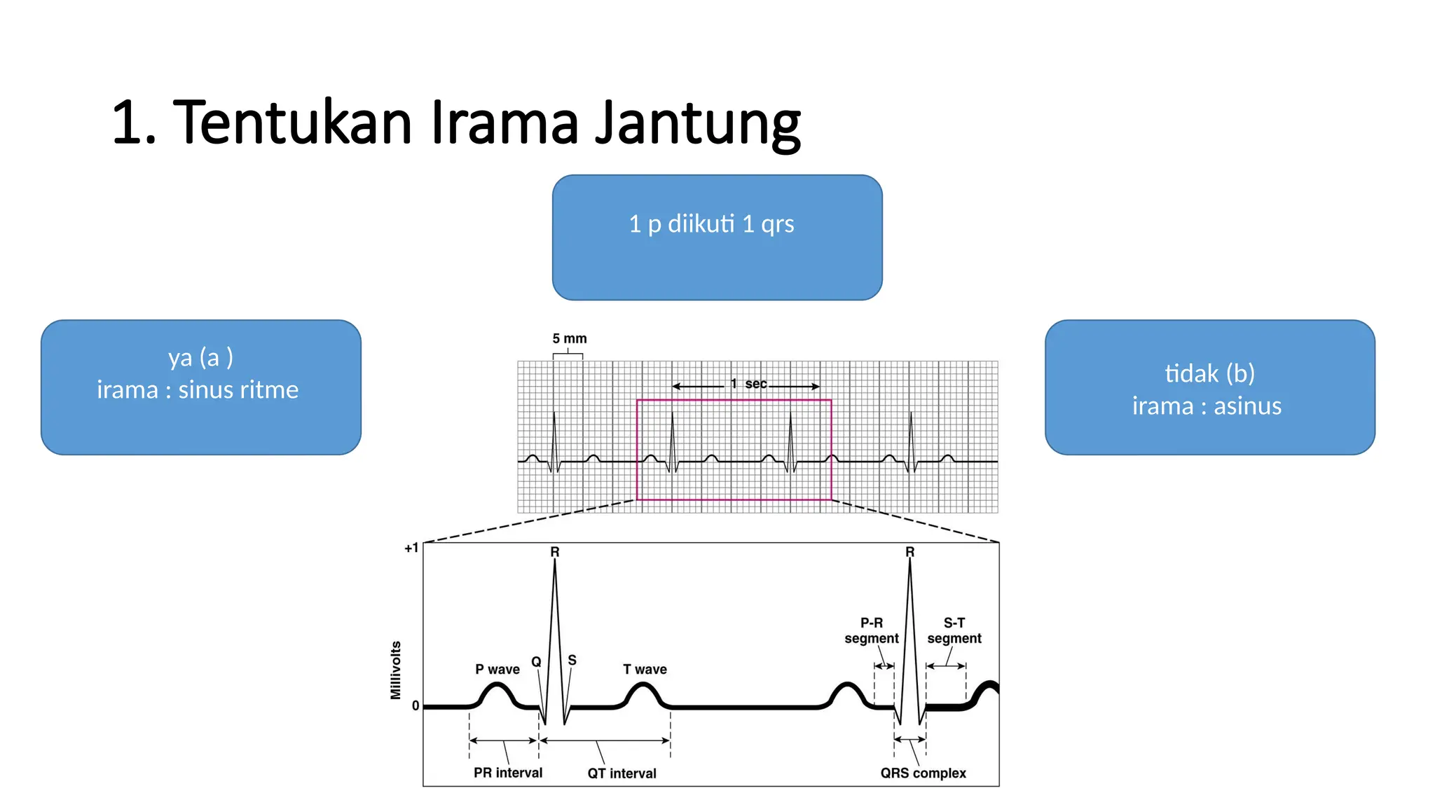 Emergency ECG in daily practice.pptx…….. | PPTX
