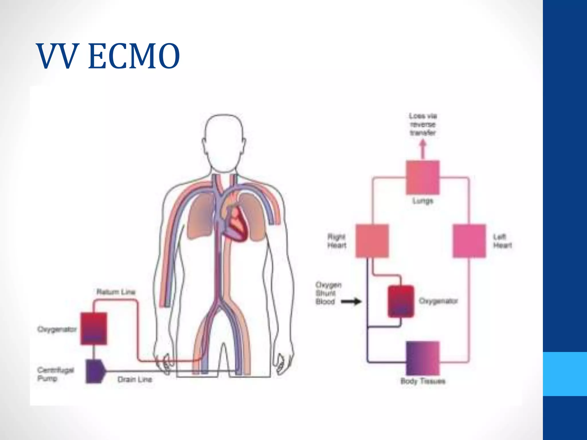 ECMO for Cardiac Arrest | PPTX