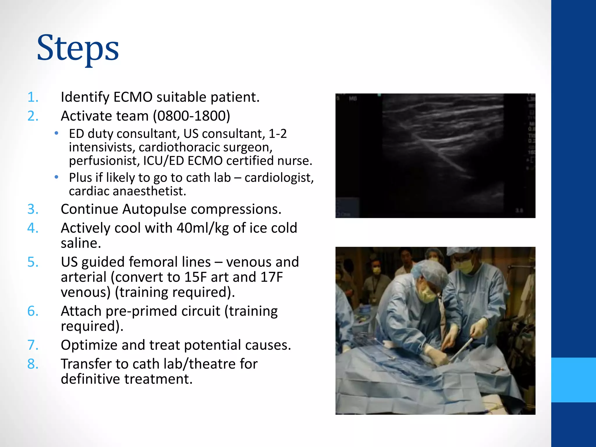 ECMO for Cardiac Arrest | PPTX