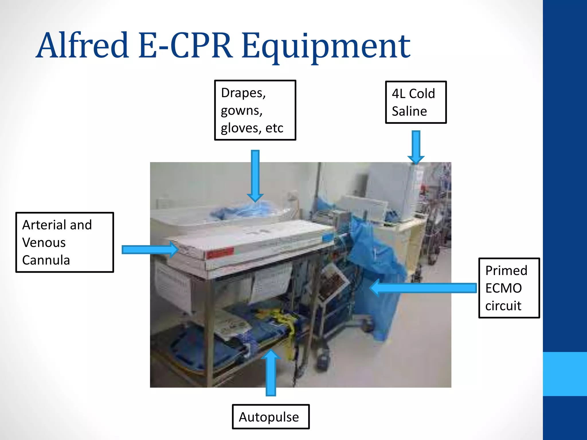ECMO for Cardiac Arrest | PPTX