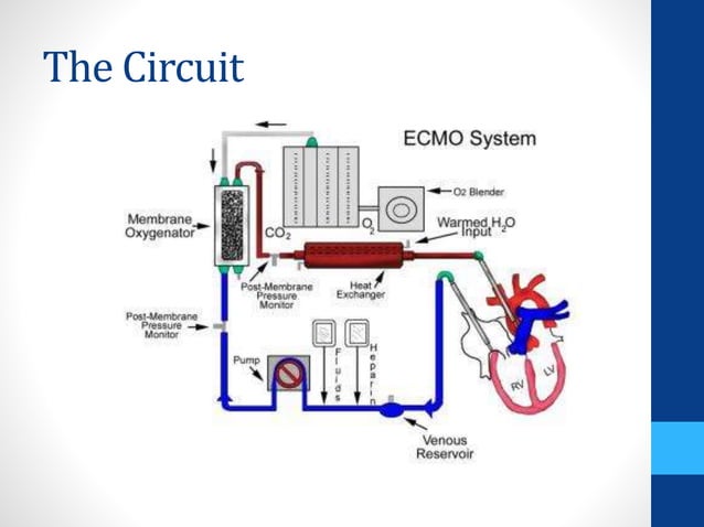ECMO for Cardiac Arrest | PPTX