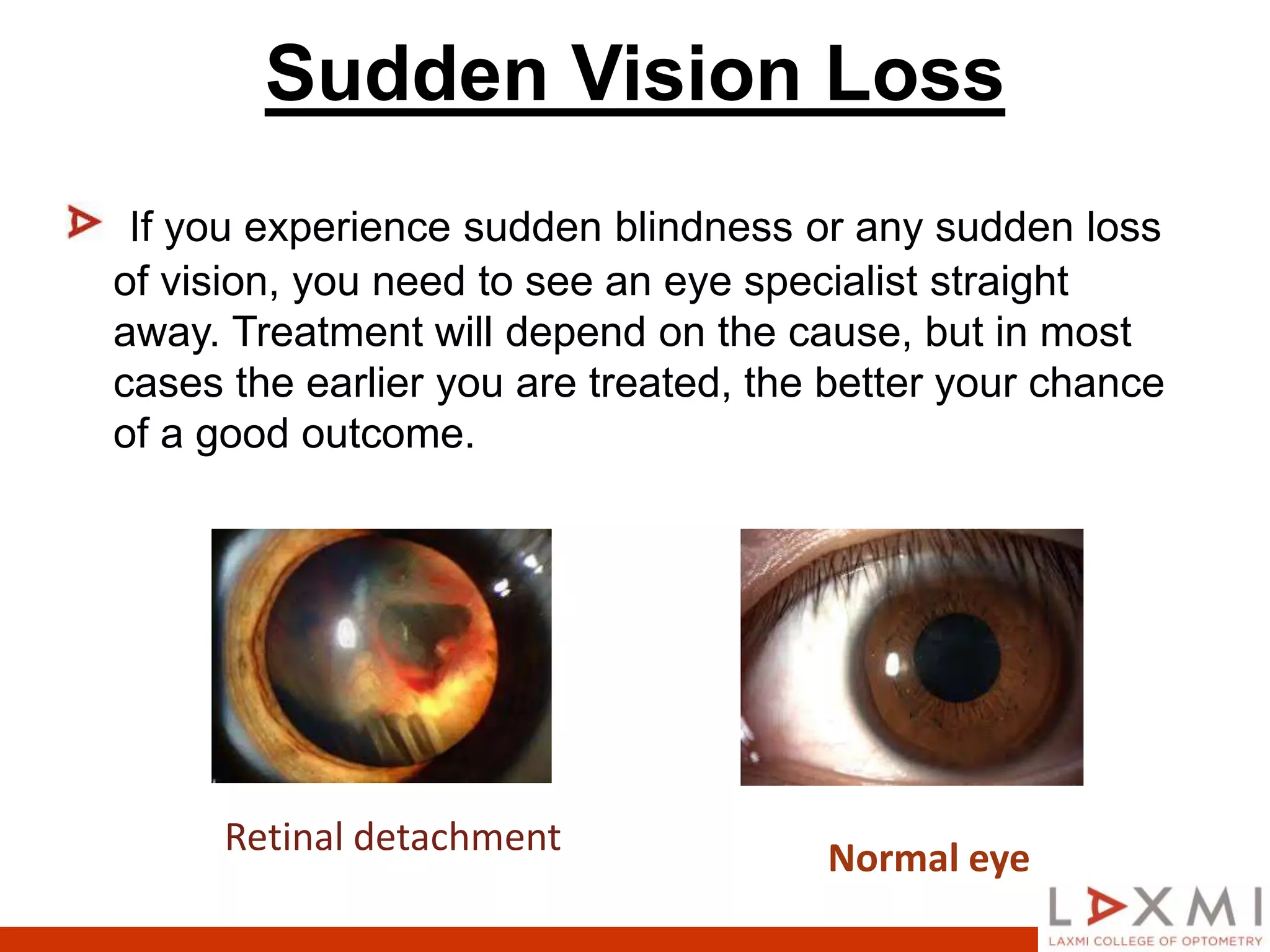 Emergency eye care | PPTX