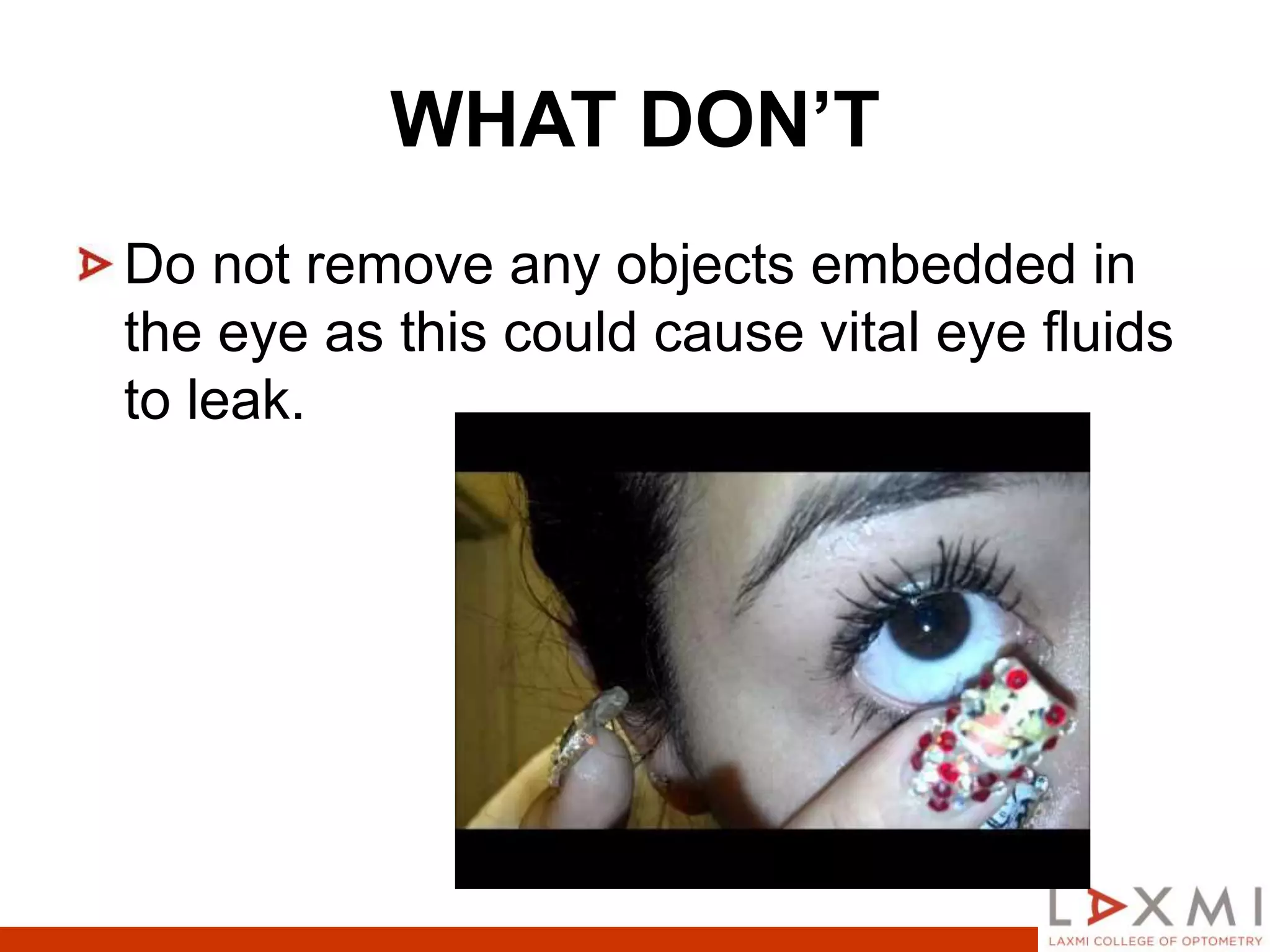 Emergency eye care | PPTX