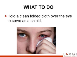 Emergency eye care | PPTX