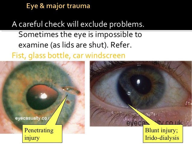 Emergency eye conditions & trauma