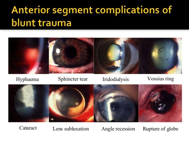 Emergency eye conditions & trauma