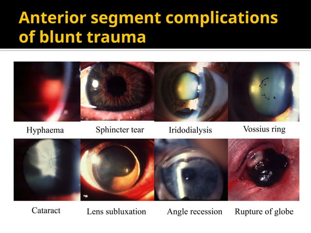 Emergency eye conditions & Trauma Riyad Banayot.pptx