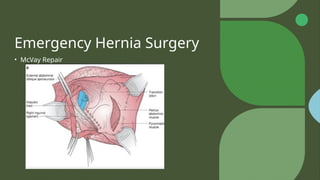 management of emergency groin hernias.pptx