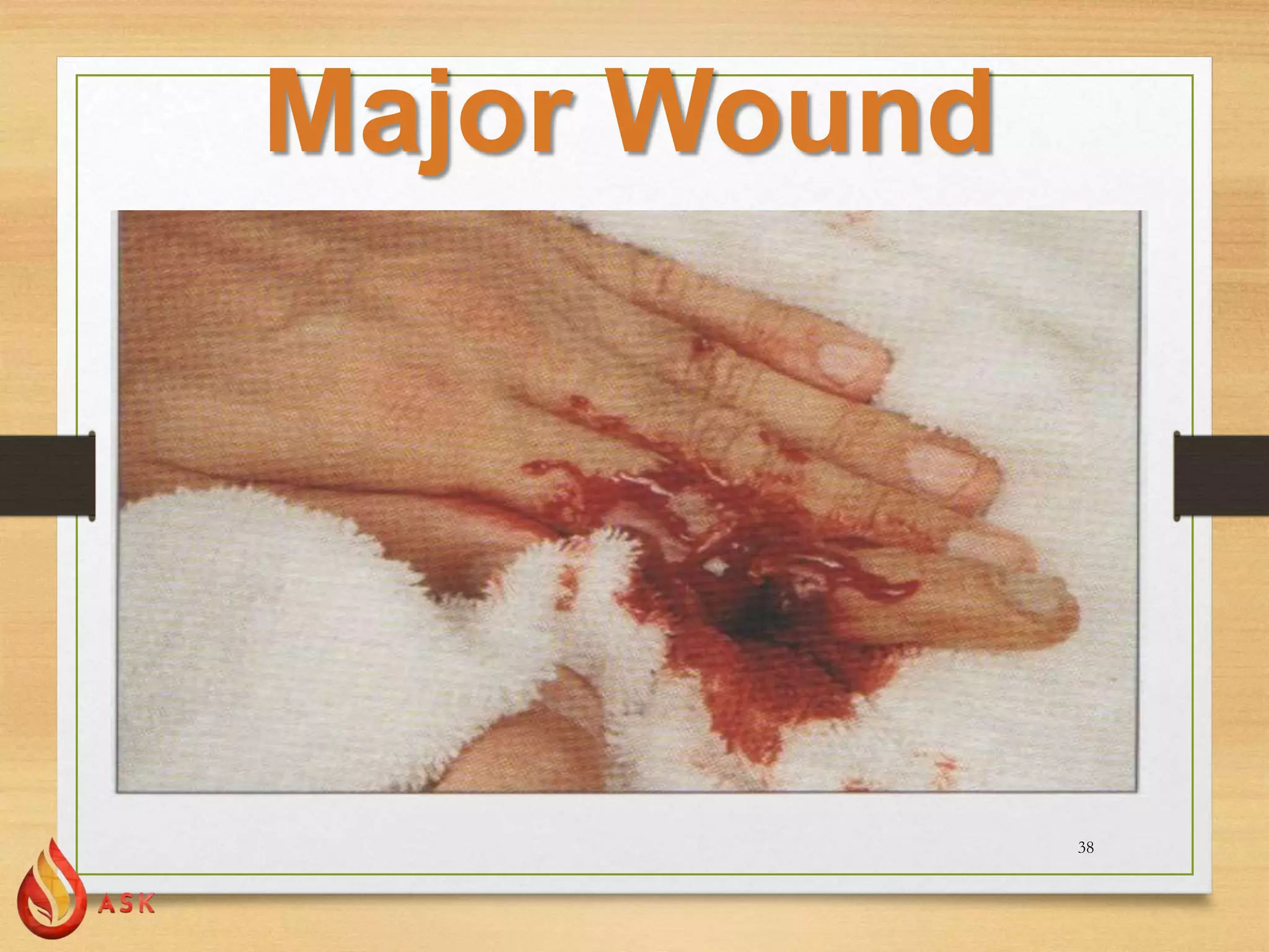 "Emergency Life Saving Skills" | PPTX