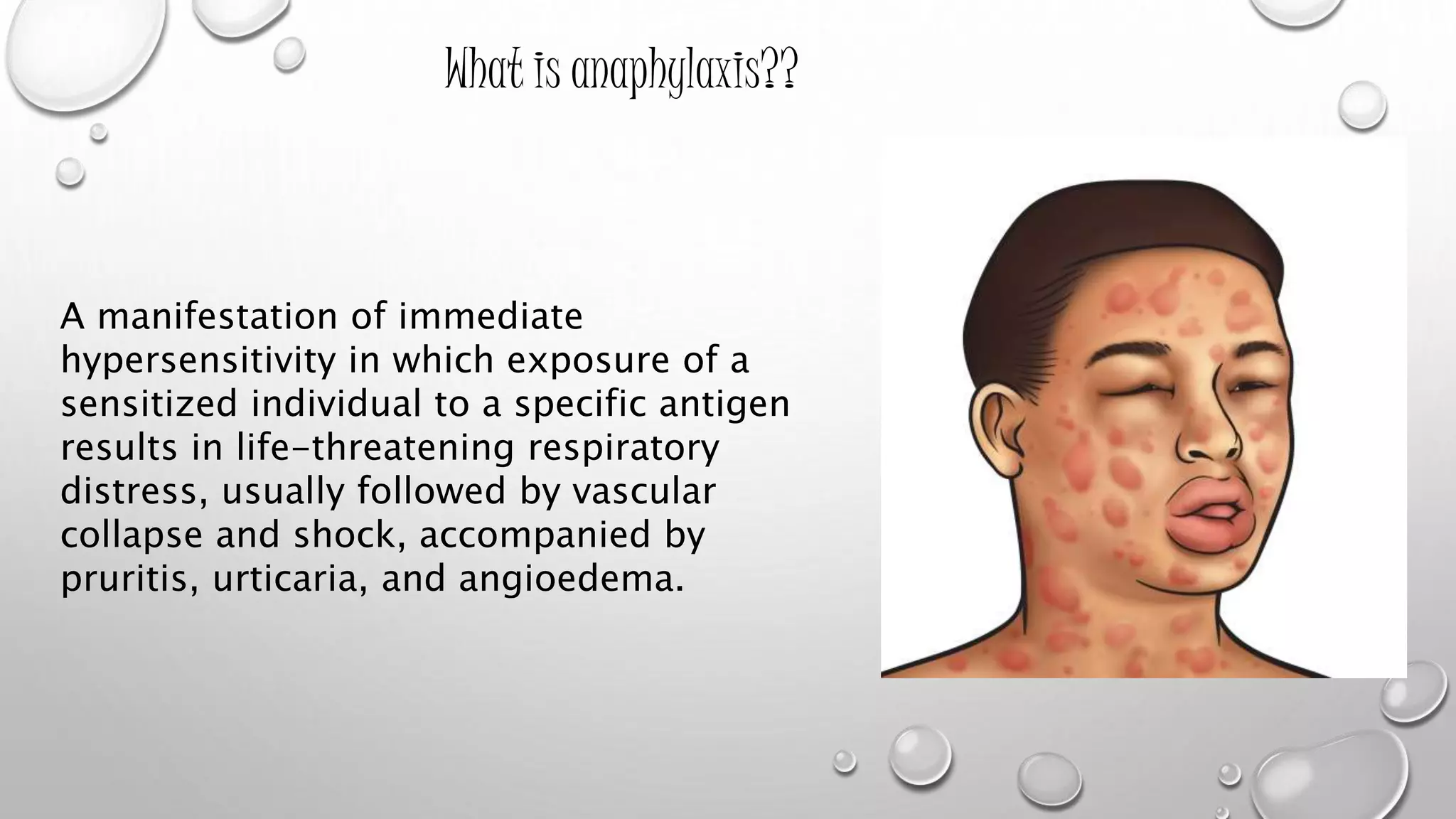 Emergency management of anaphylactic shock | PPTX