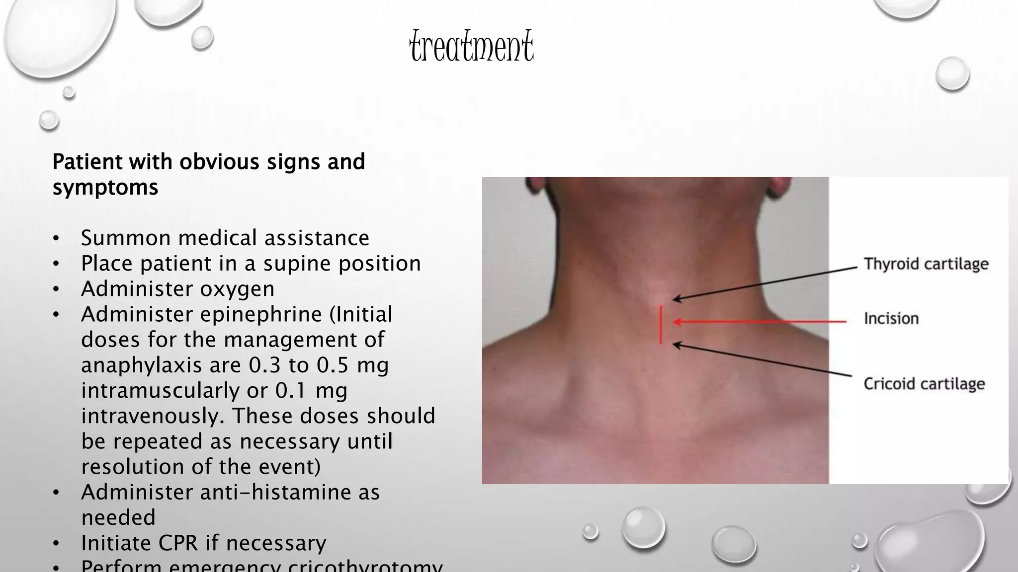 Emergency management of anaphylactic shock | PPTX