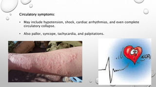 Emergency Management Of Anaphylactic Shock Pptx
