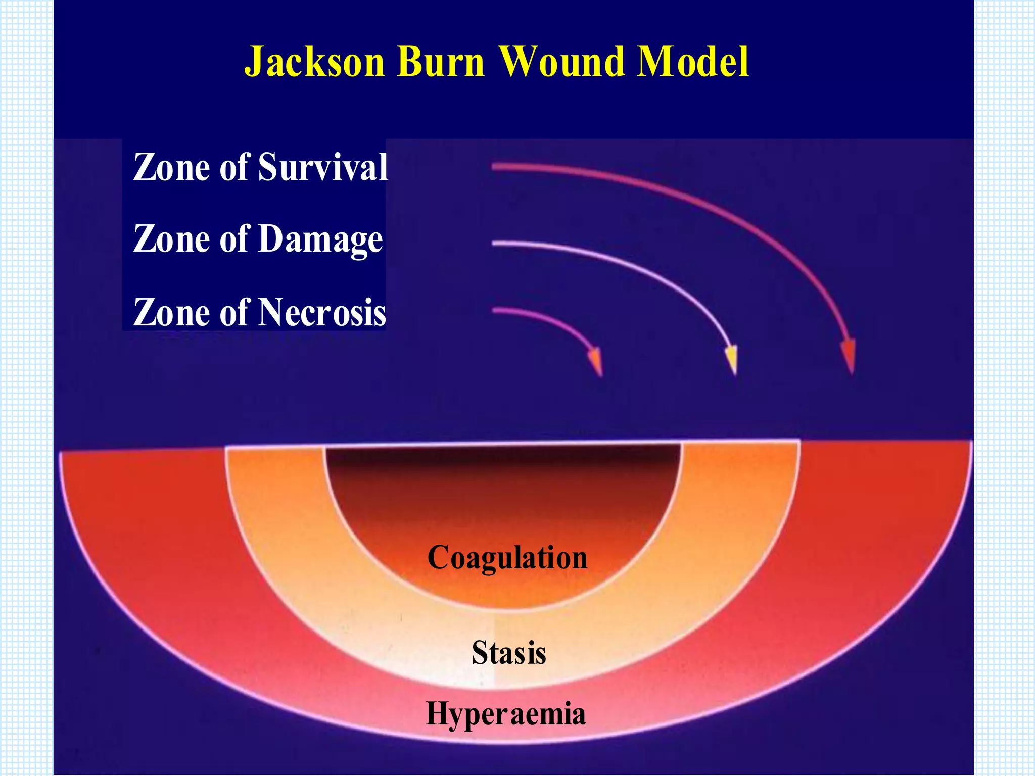 Emergency management of burn | PDF