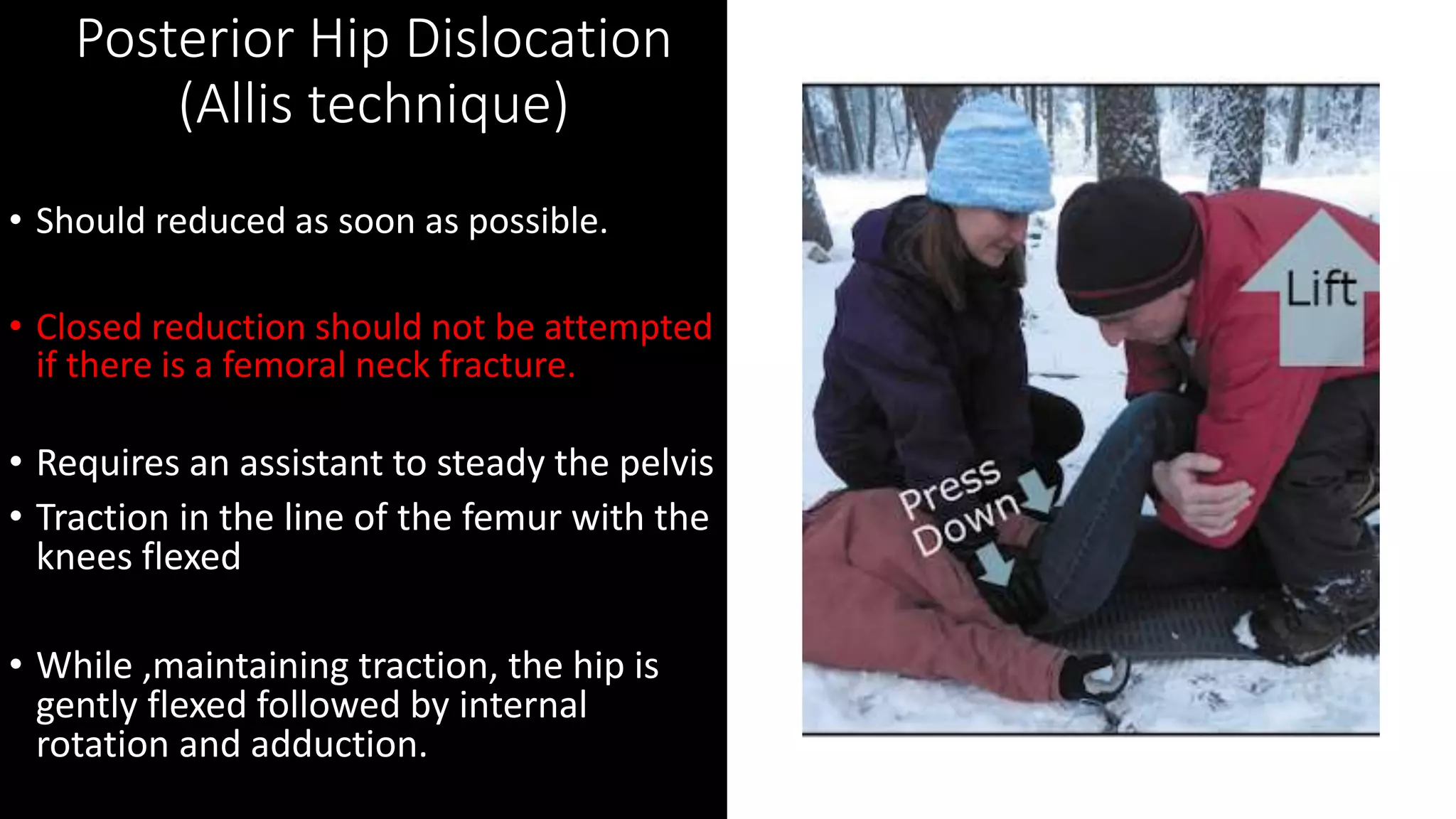 Emergency management of common dislocations | PPTX