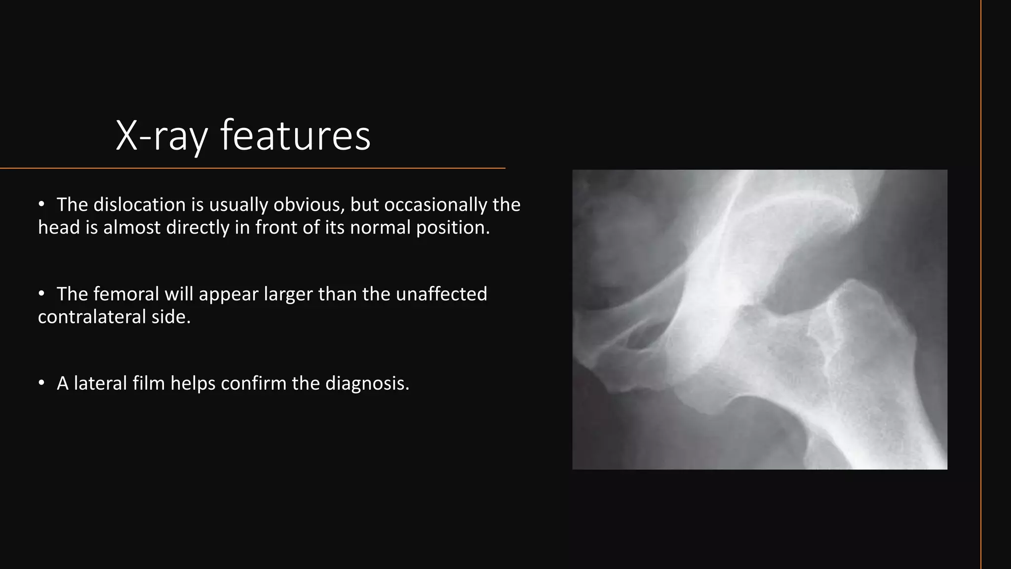 Emergency management of common dislocations | PPTX