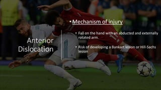 Emergency management of common dislocations | PPTX