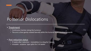 Emergency management of common dislocations | PPTX