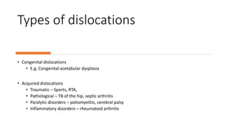 Emergency management of common dislocations | PPTX