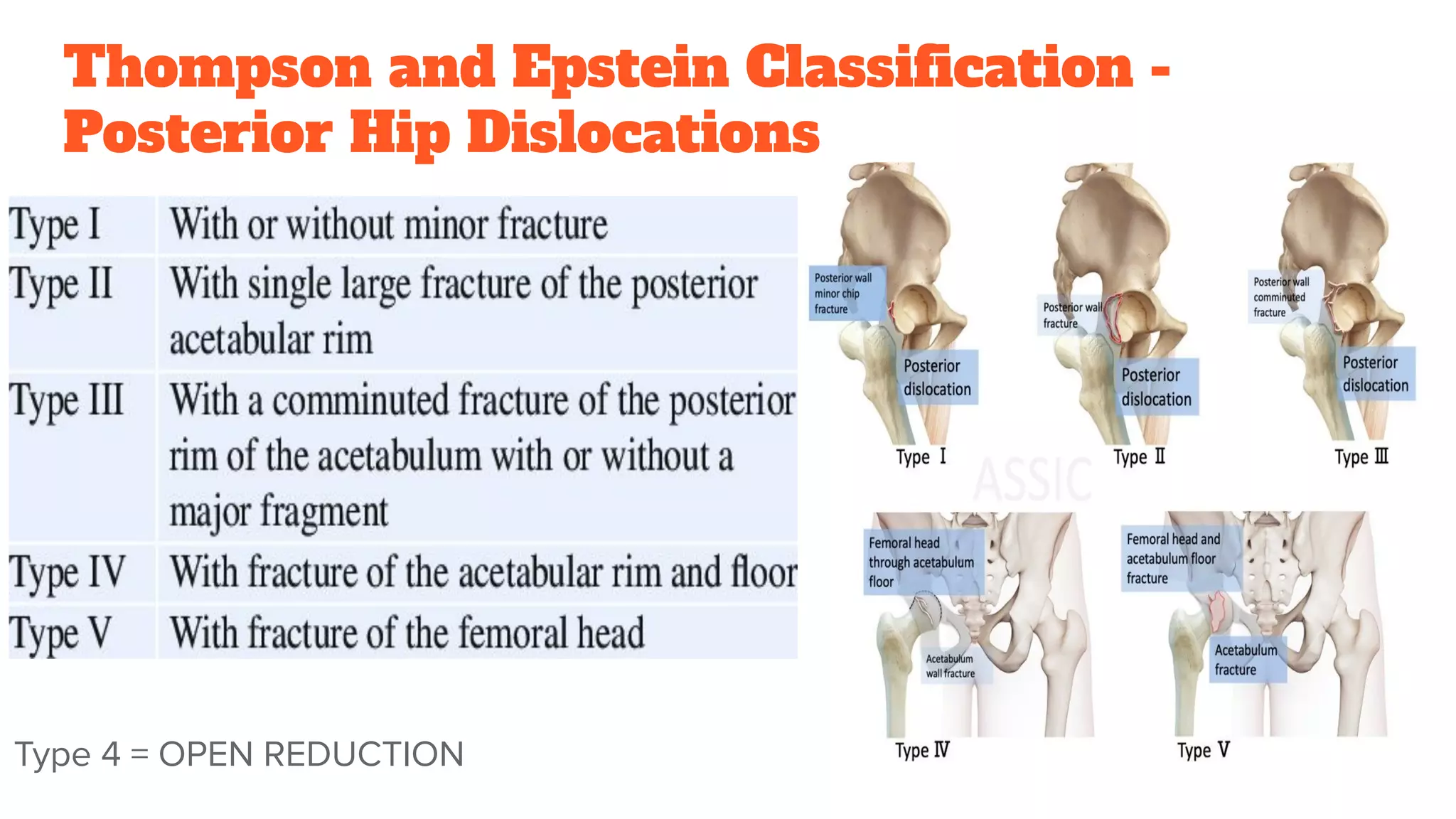 Emergency Management of Hip Dislocations & Pelvic Fractures.pdf