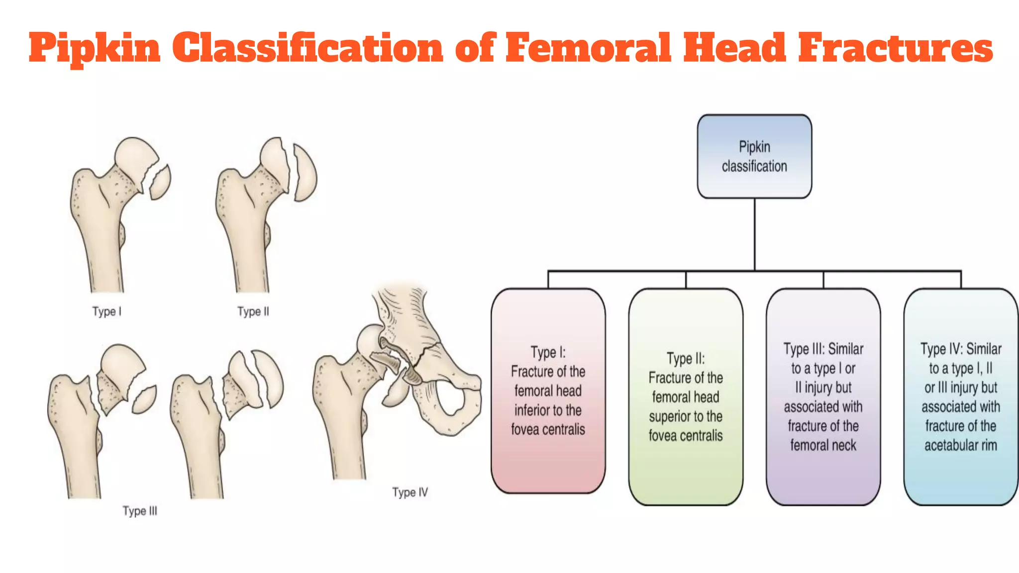 Emergency Management of Hip Dislocations & Pelvic Fractures.pdf
