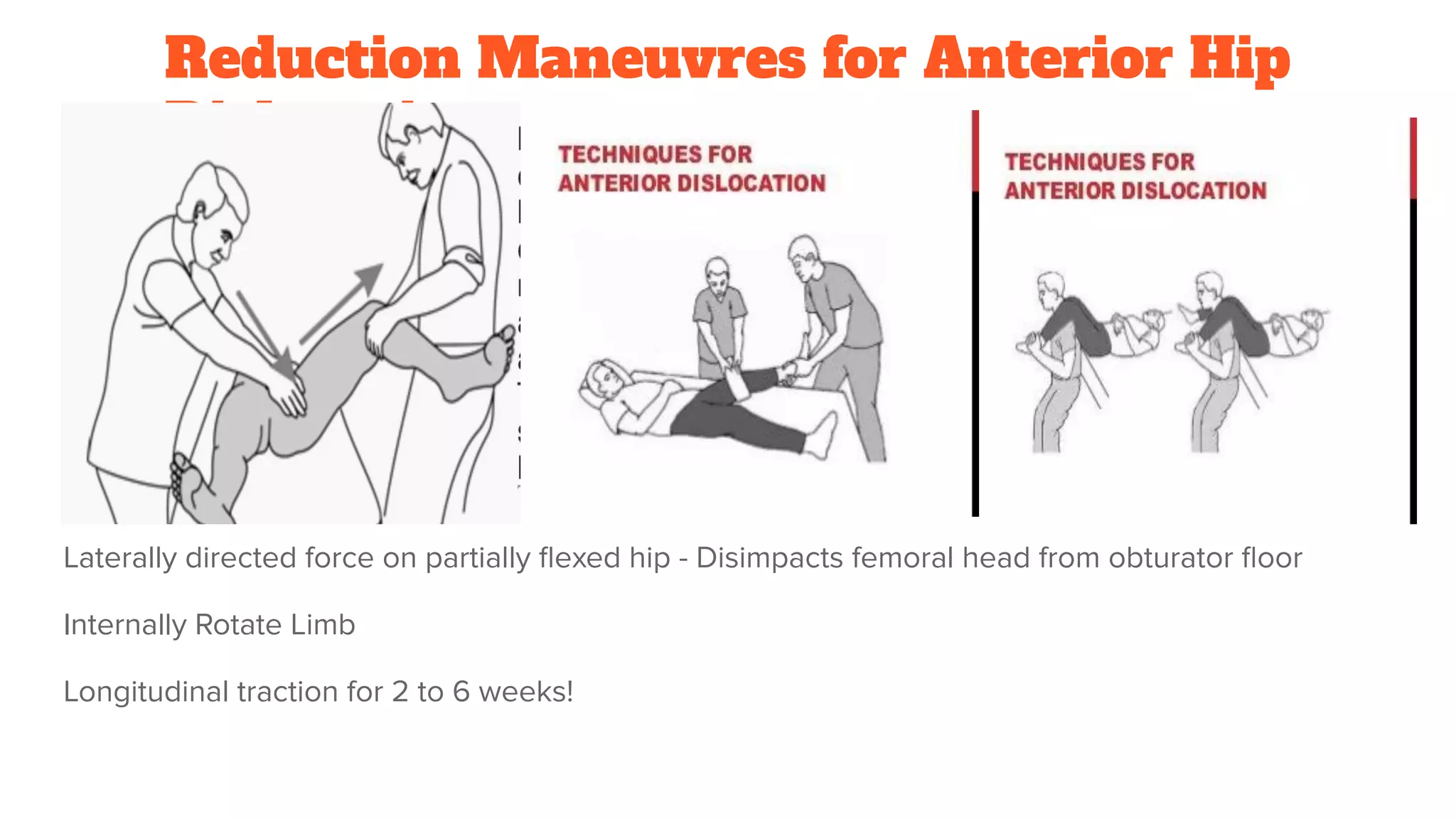 Emergency Management of Hip Dislocations & Pelvic Fractures.pdf