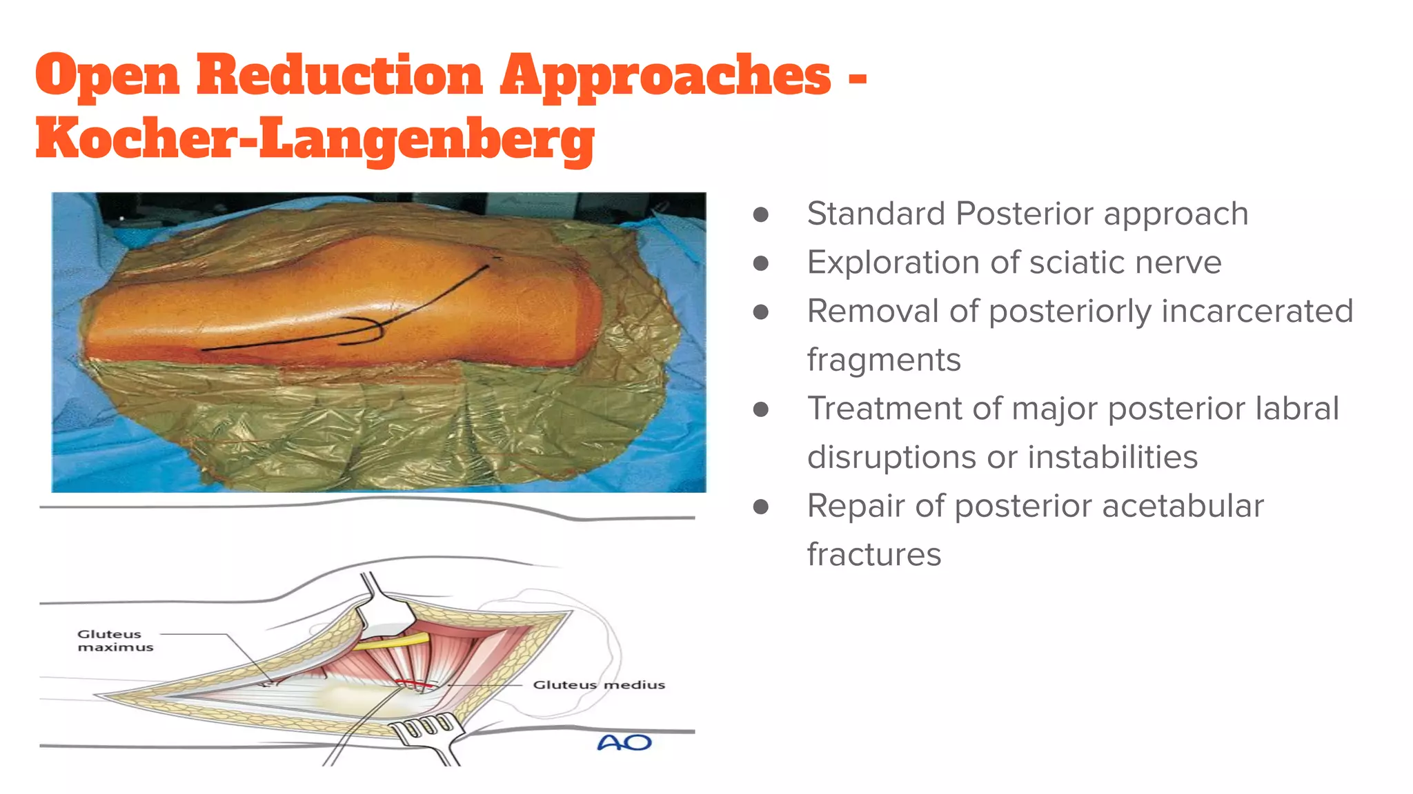 Emergency Management of Hip Dislocations & Pelvic Fractures.pdf