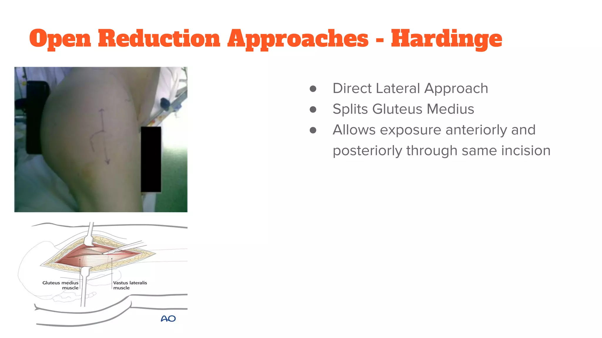 Emergency Management of Hip Dislocations & Pelvic Fractures.pdf