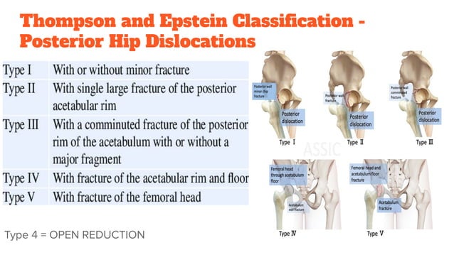 Emergency Management of Hip Dislocations & Pelvic Fractures.pdf