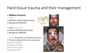 Emergency management of oral and maxillofacial trauma including_100844.pptx