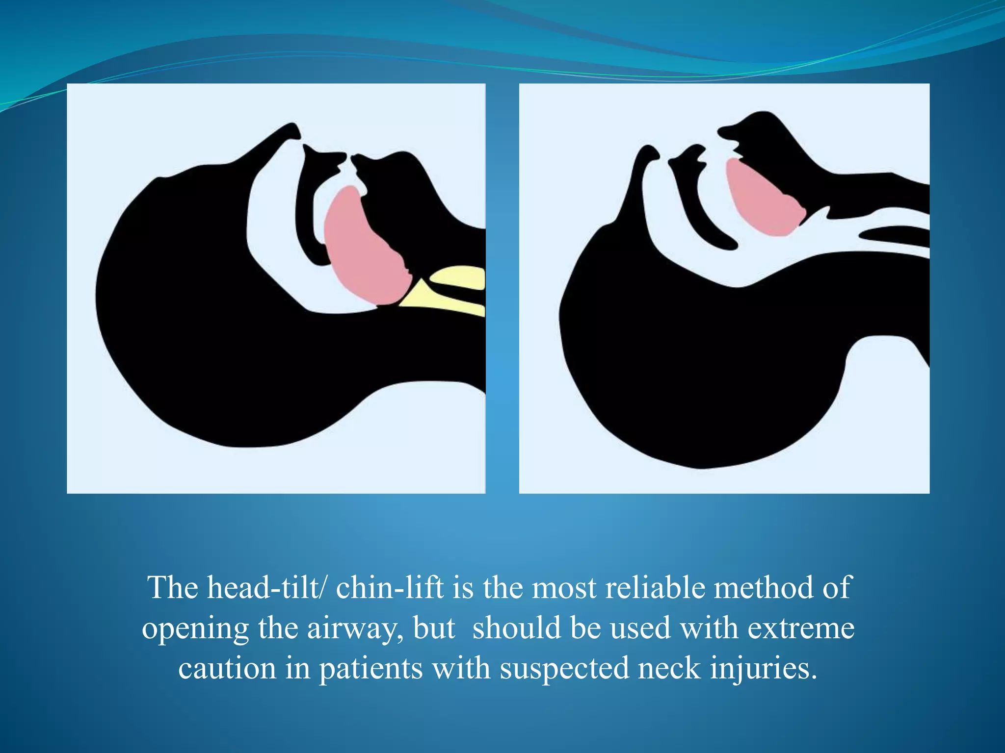 Emergency management of patients with facial trauma | PPTX